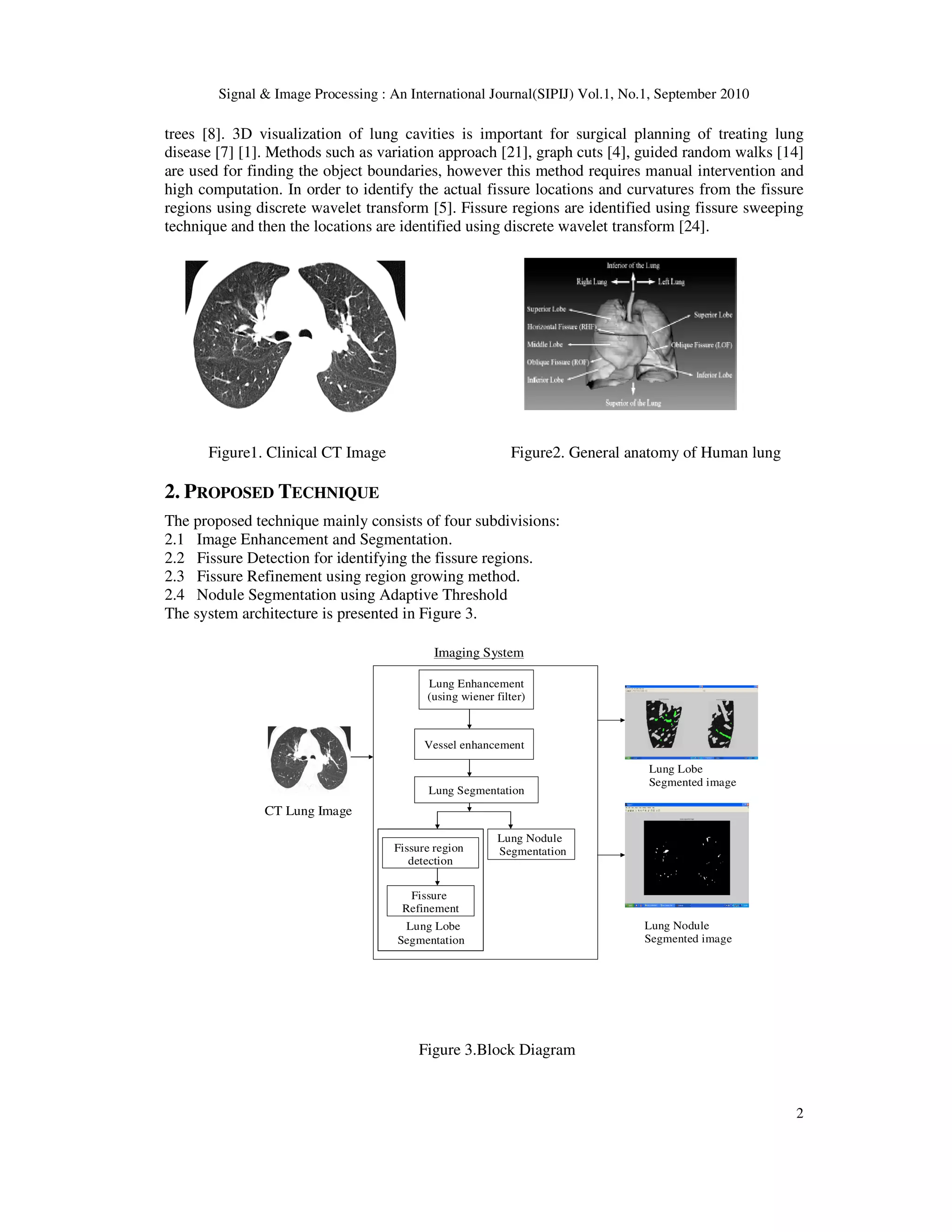 Segmentation of Lung Lobes and Nodules in CT Images | PDF Segmentation of Lung Lobes and Nodules in CT Images | PDF