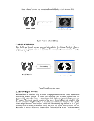 Segmentation of Lung Lobes and Nodules in CT Images | PDF