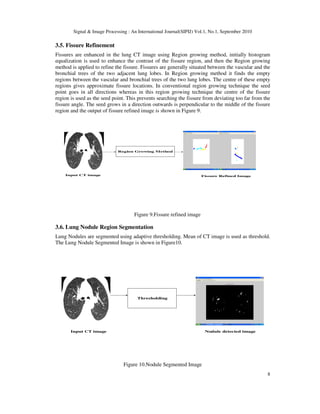 Segmentation of Lung Lobes and Nodules in CT Images | PDF