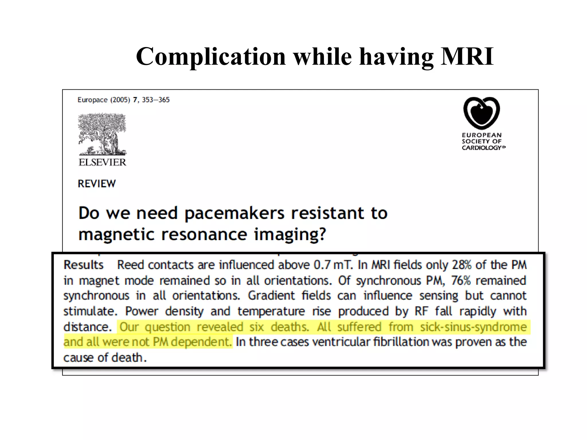 New Technology: 核磁共振相容節律器 - ”MRI Standard of Care for Pacemaker ...