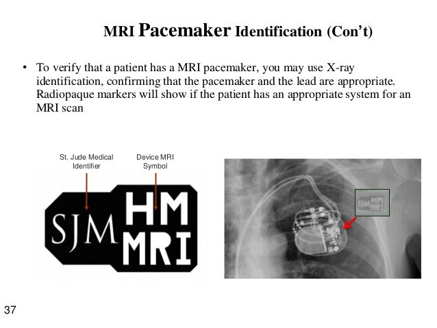 New Technology: 核磁共振相容節律器 - ”MRI Standard of Care for Pacemaker”)_20…