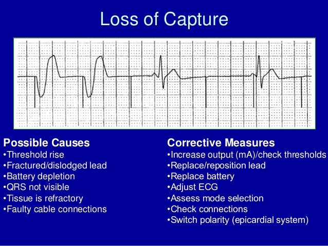 心臟植入性電子儀器(CIED )護理照護指引- Cathroom Troubleshooting_20130914中區