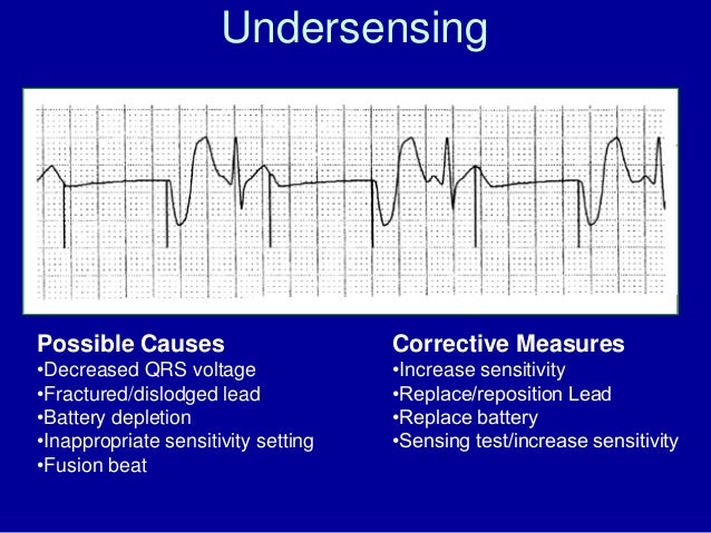心臟植入性電子儀器(CIED )護理照護指引- Cathroom Troubleshooting_20130914中區