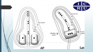 ICRU 38 nayana | PPTX