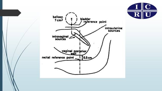 ICRU 38 nayana | PPTX | Medical Health