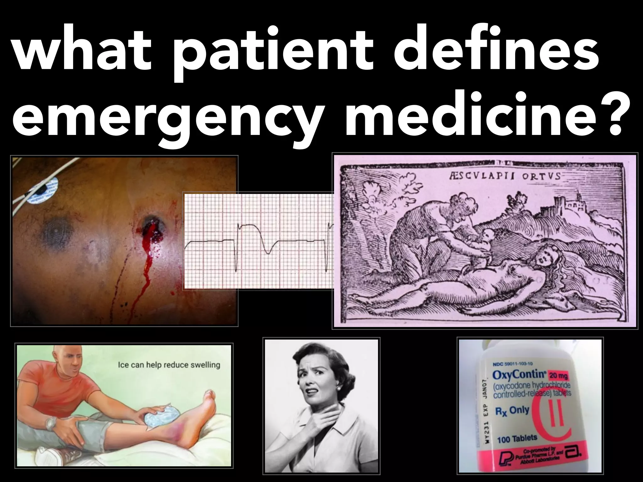 Emergency management of agitation: Reuben Strayer | PDF