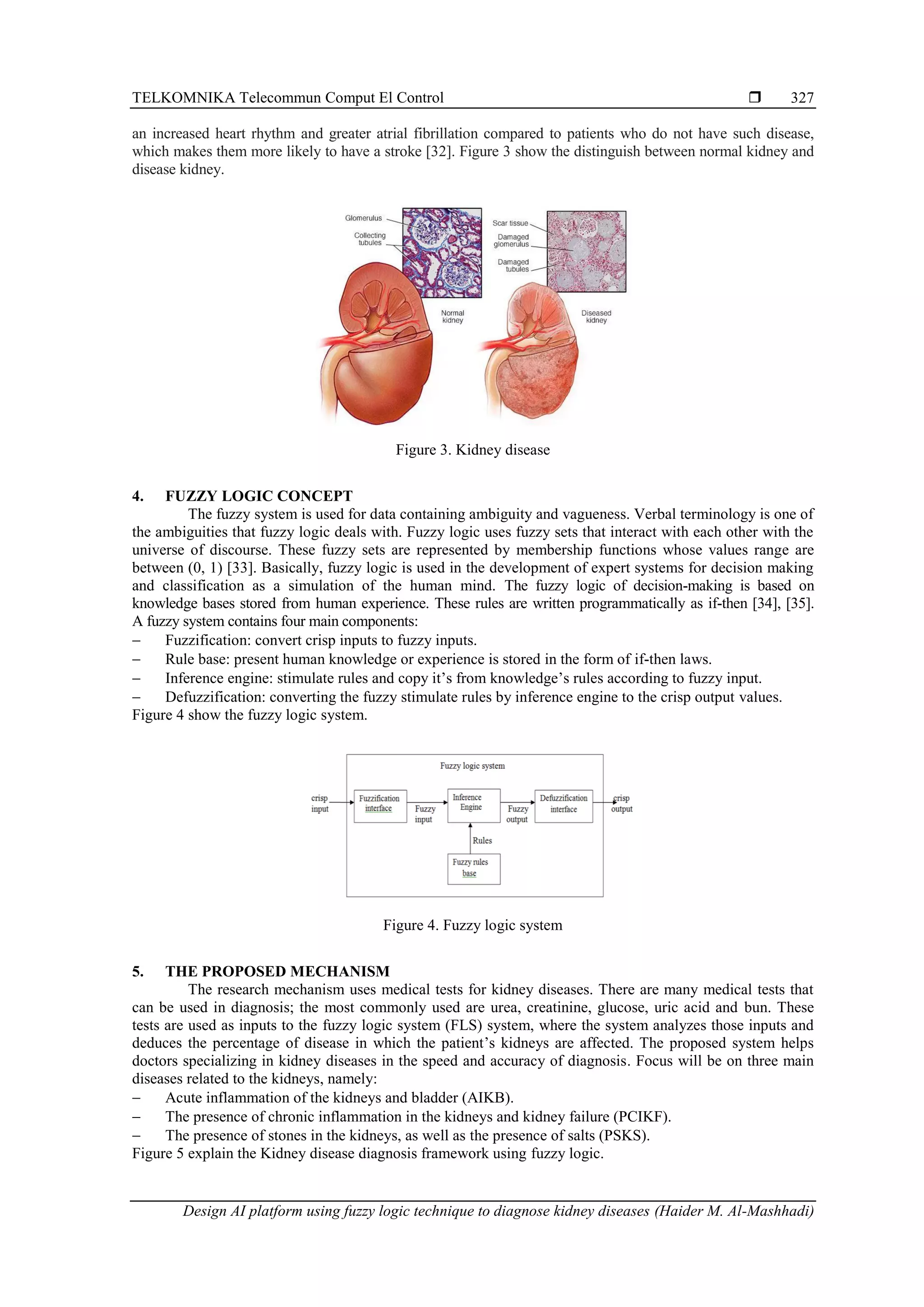 Design AI platform using fuzzy logic technique to diagnose kidney diseases | PDF