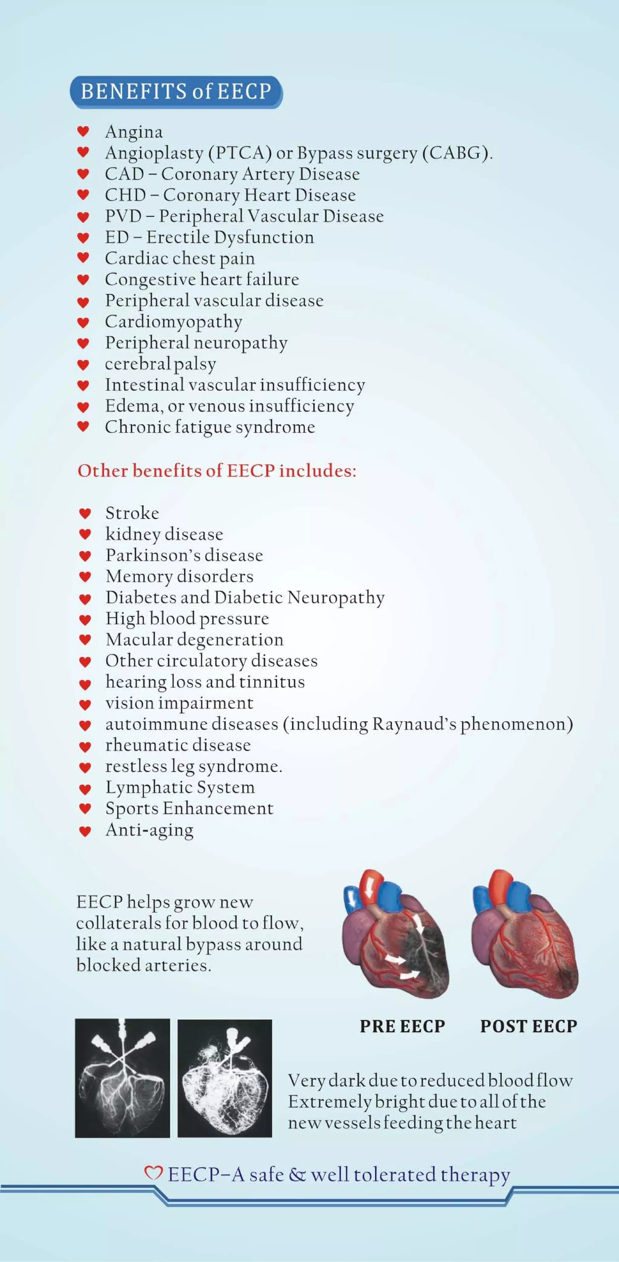ECP brochure | PDF