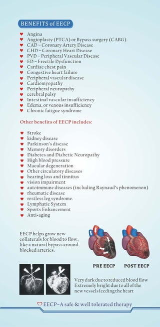ECP brochure | PDF