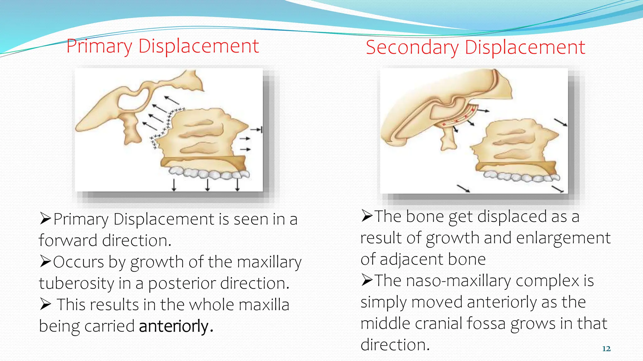 GROWTH AND DEVELOPMENT OF MAXILA 16.pptx