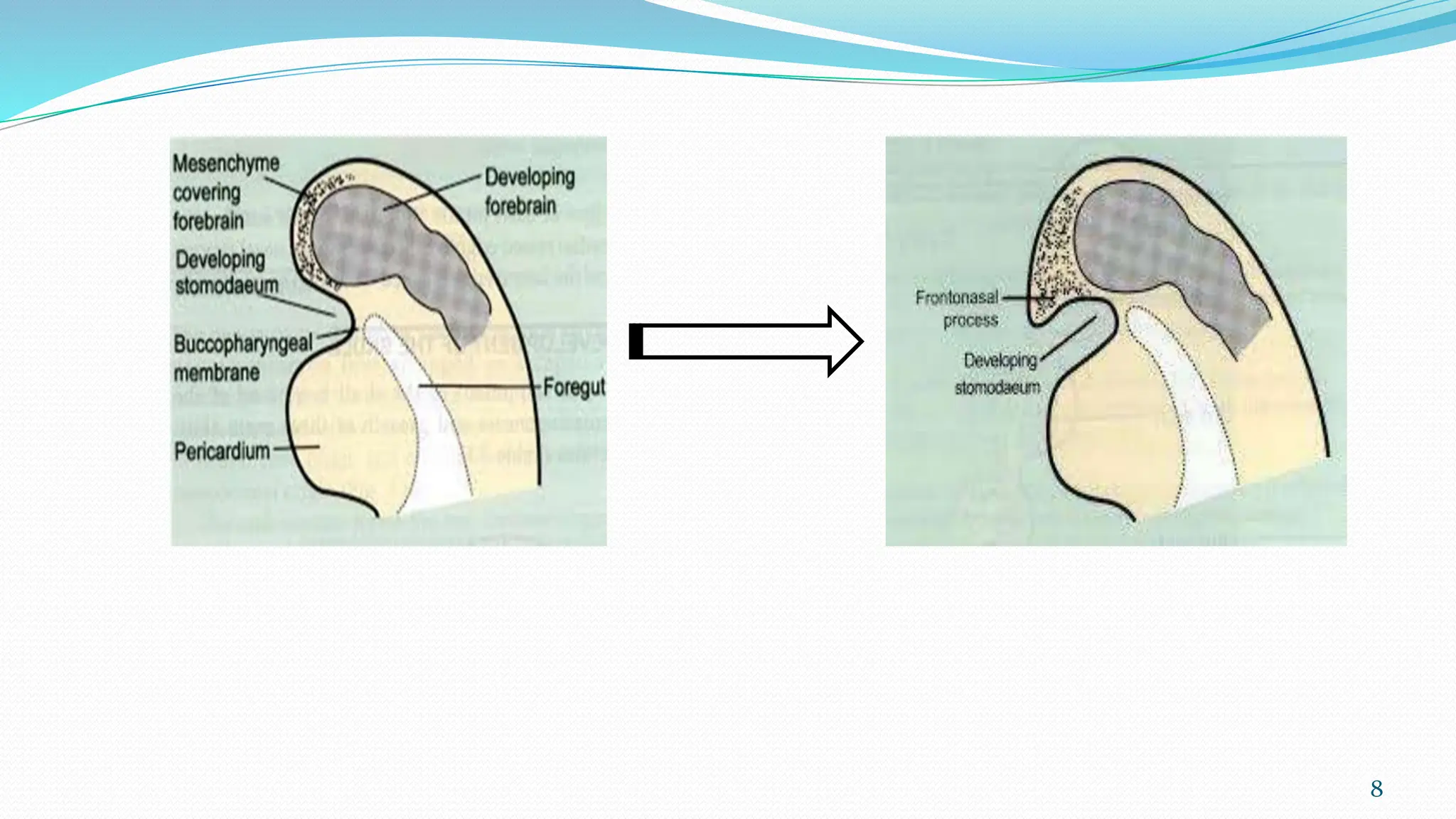 GROWTH AND DEVELOPMENT OF MAXILA 16.pptx