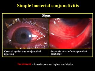 09Conjunctival Infections.ppt