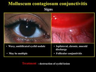 09Conjunctival Infections.ppt