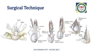 Hydrocele - ASI Guest Lecture | PPTX