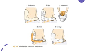 above elbow backstab as seen in adlt.pptx