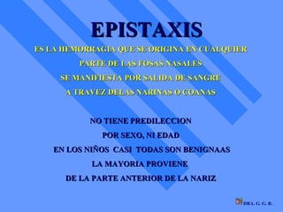 oto 09 Epistaxis | PPT