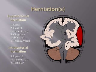 Ventriculostomies and Licox | PPTX