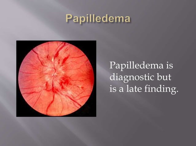 Ventriculostomies and Licox | PPT