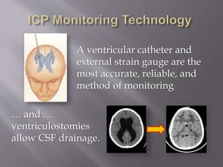 Ventriculostomies and Licox | PPTX