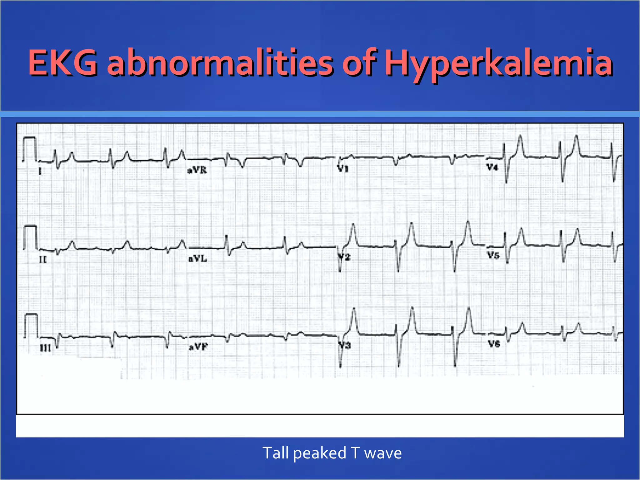 TAEM10:Electrolyte emergency | PPT