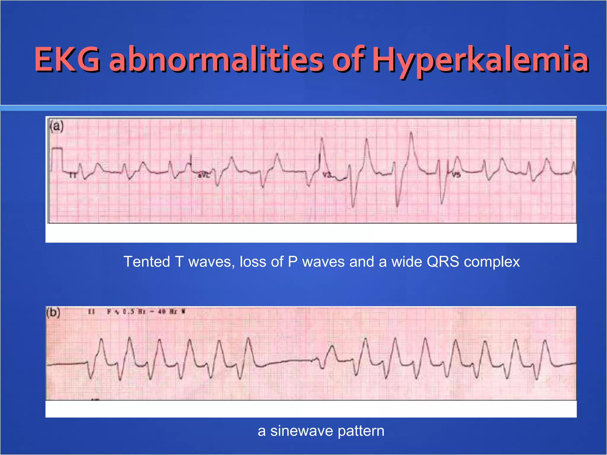 TAEM10:Electrolyte emergency | PPT