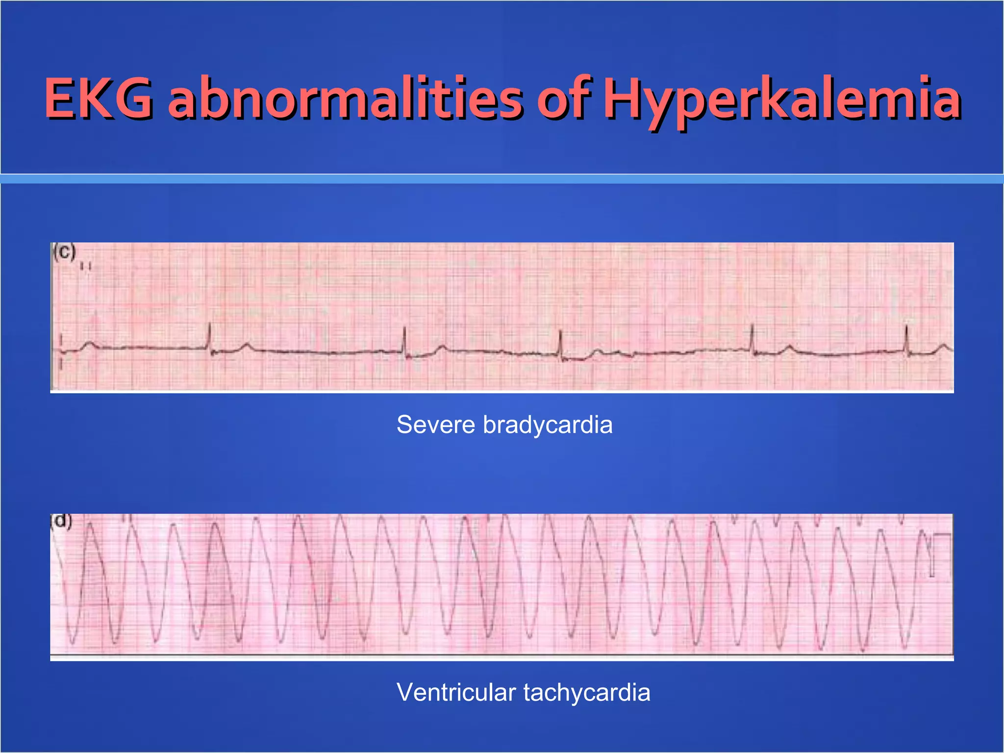 TAEM10:Electrolyte emergency | PPT