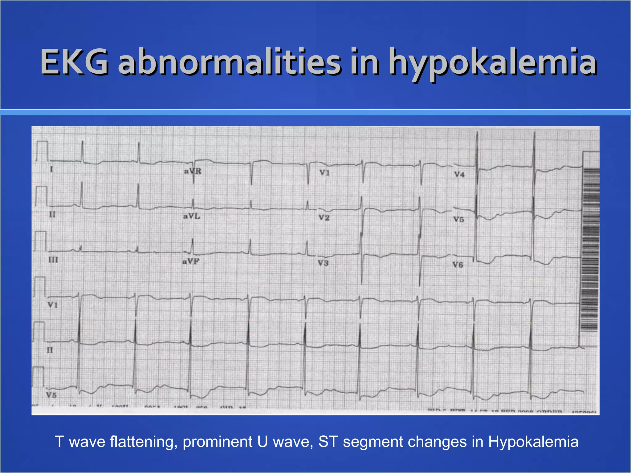 TAEM10:Electrolyte emergency | PPT