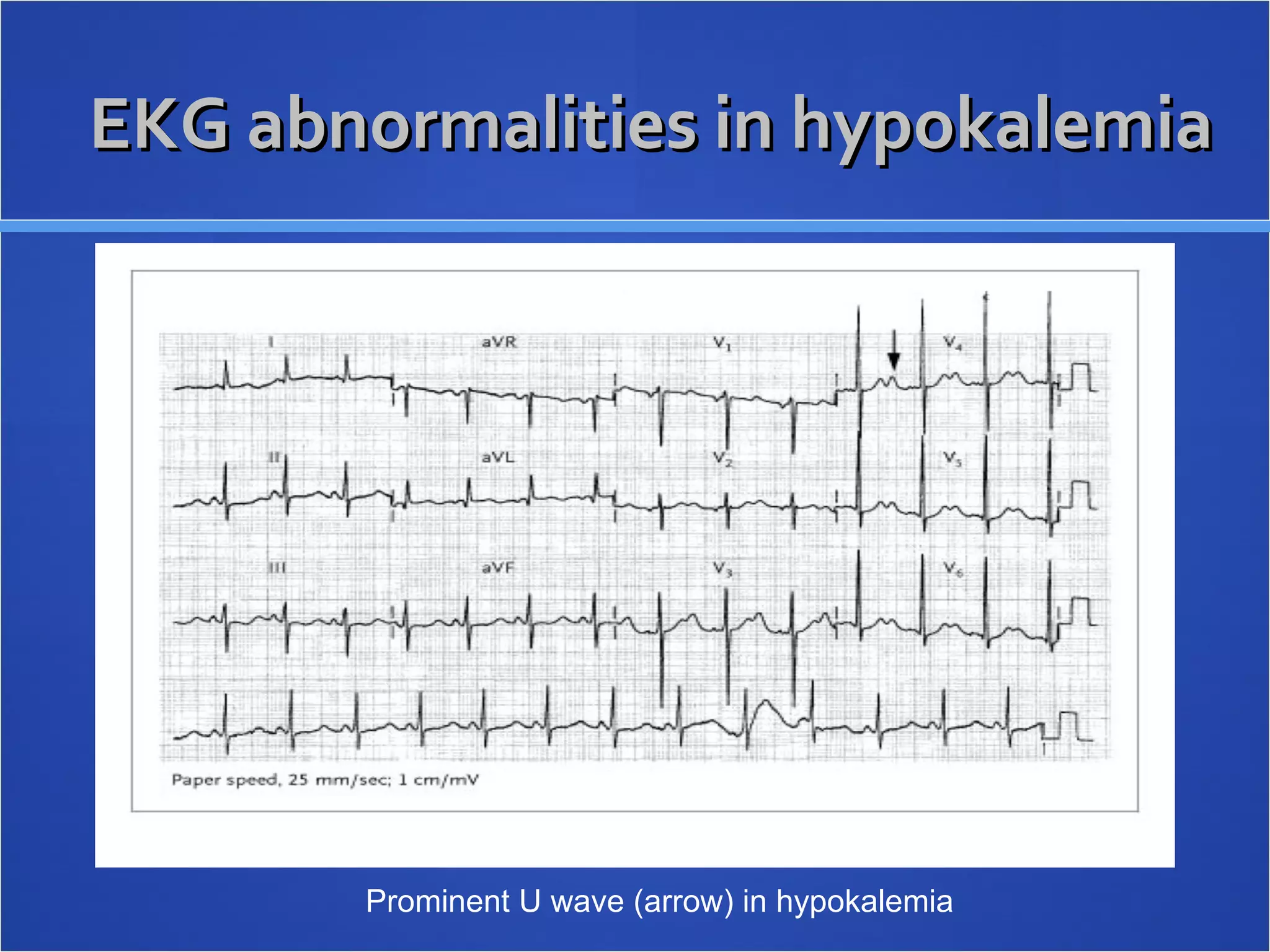 TAEM10:Electrolyte emergency | PPT