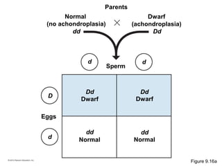 Achondroplasia Dwarfism Punnett Square