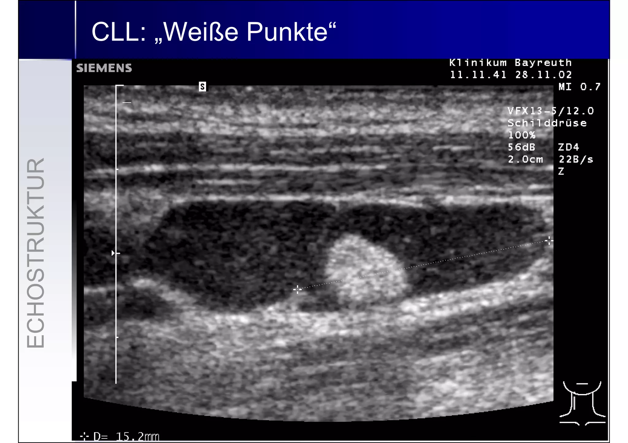 09 Lymphknotensonographie 2. Sonographietechnik der akuten Lymphknote…