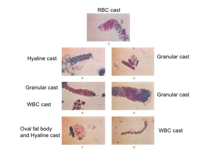 09 Nouri Acute Renal Failure