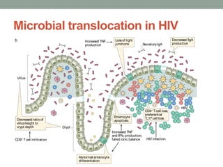 BRN Symposium 03/06/16 The gut microbiome in HIV infection | PPTX