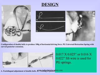 PG retraction spring for canine & incisor /certified fixed orthodontic ...