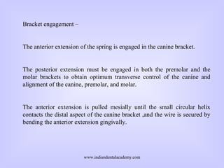 PG Retraction Spring for Canine & Incisor /certified fixed orthodontic ...