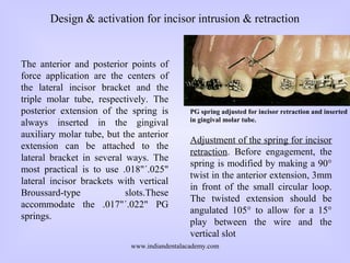 PG Retraction Spring for Canine & Incisor /certified fixed orthodontic ...