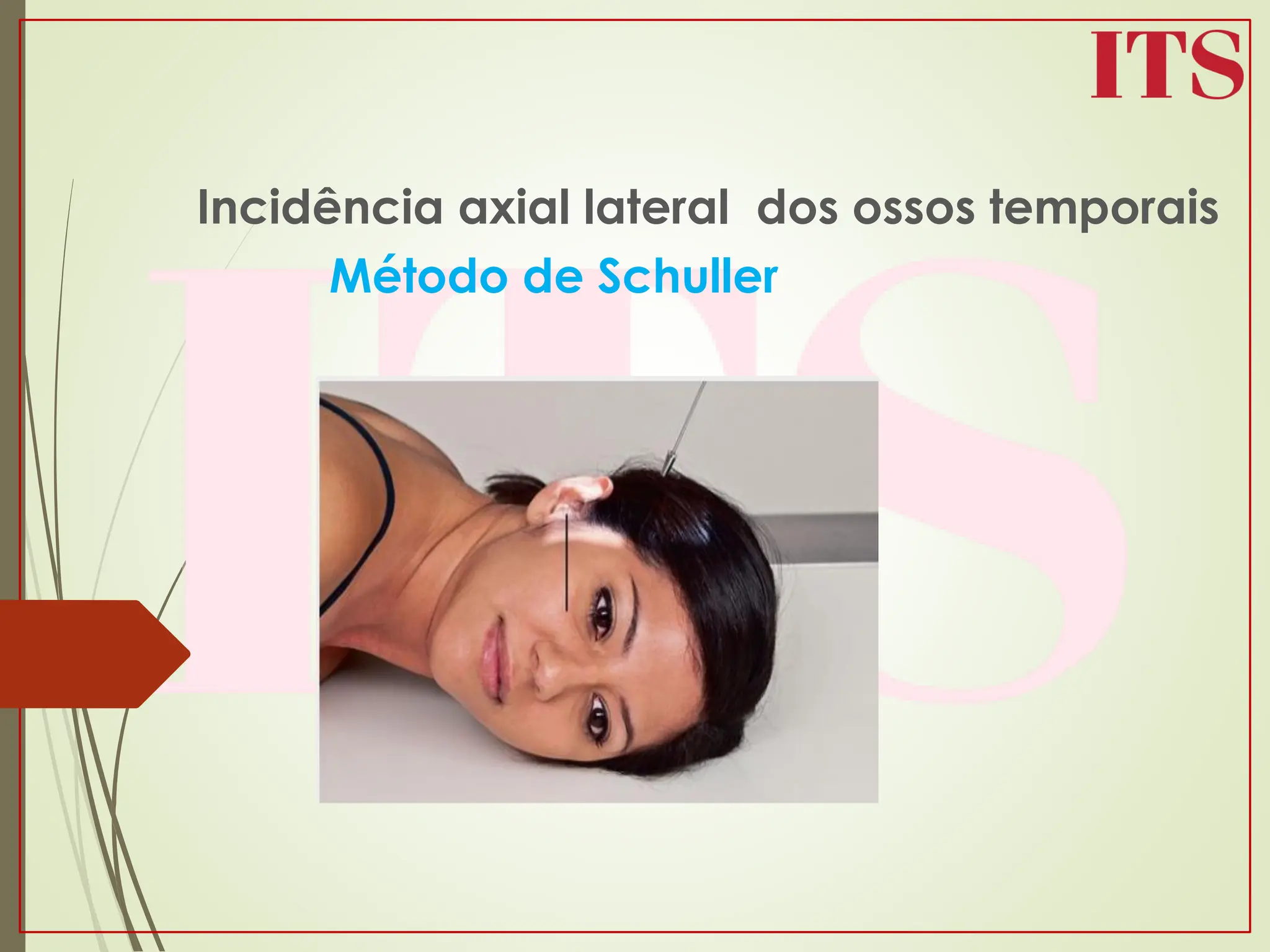 09 POSICIONAMENTOS DOS OSSOS DA FACE.pdf
