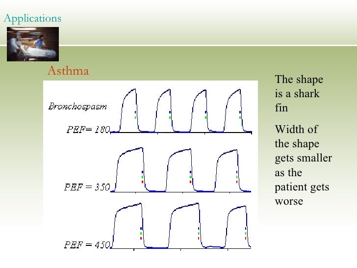 09 pre hospital capnography