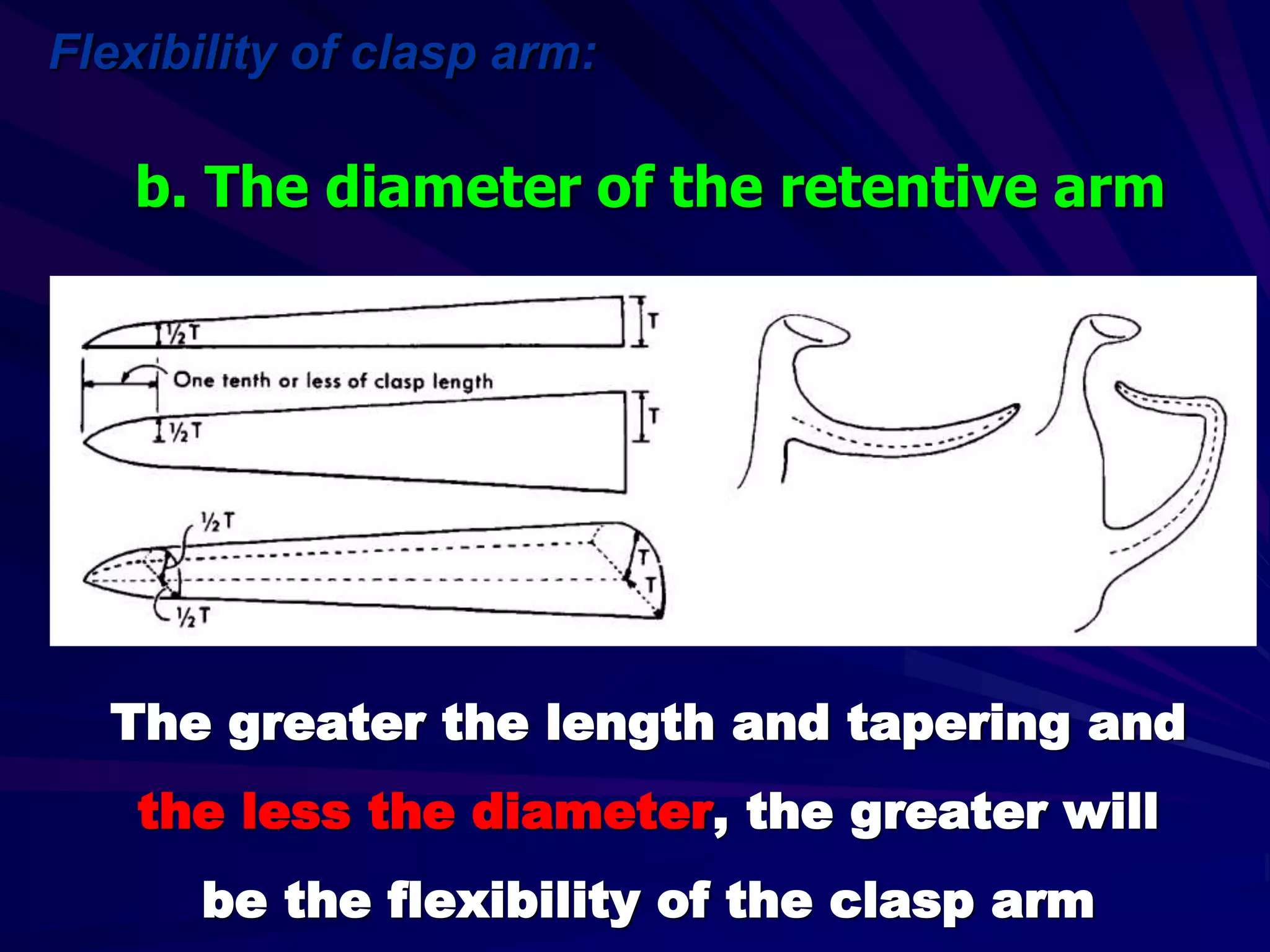 A- Retention of Removable Partial Dentures | PPT