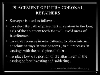 surveyors in Removable partial Dentures/RPD | PPT