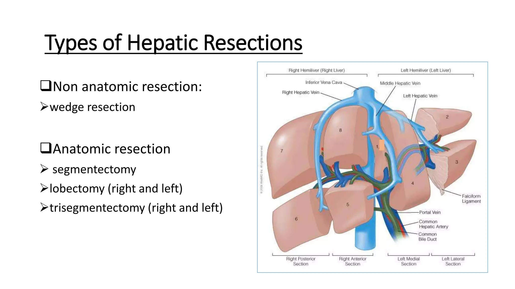 MANAGEMENT OF HEPATOCELLULAR CARCINOMA | PPTX