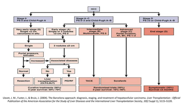 MANAGEMENT OF HEPATOCELLULAR CARCINOMA | PPTX