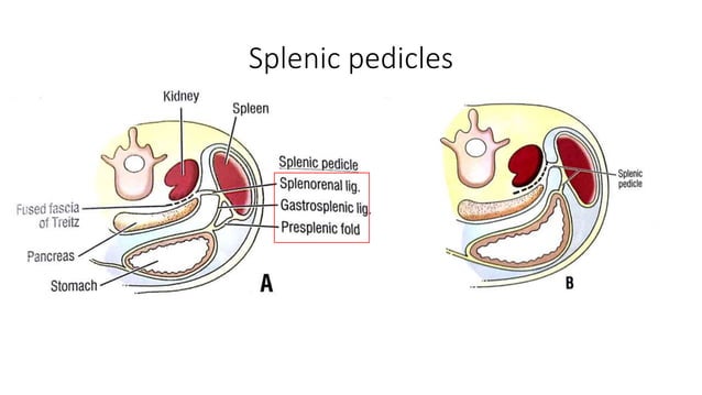 Applied Anatomy and Physiology of spleen | PPTX | Digestive Disorders ...