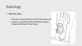 Ankle Fractures.pptx