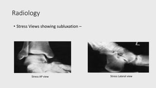 Ankle Fractures.pptx