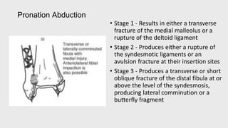 Ankle Fractures.pptx
