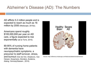 Alzheimer’s Disease | PPT