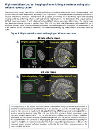 Quantum GX Contrast Agents APPnote 20160603 | PDF