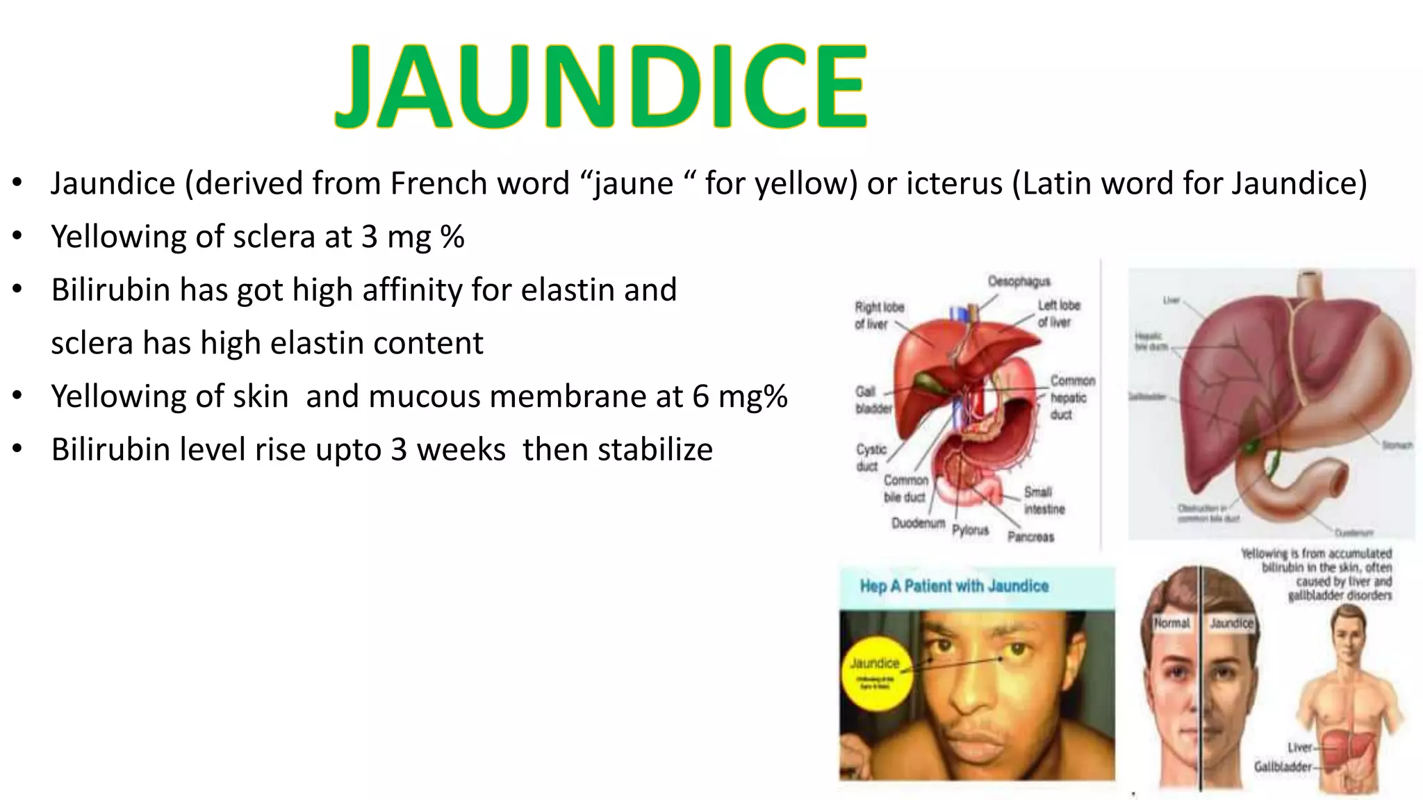 0bstructive jaundice.pptx