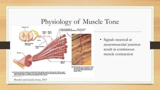 Tone Management | PPTX