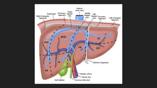 Liver trauma | PPTX